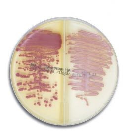 Prepared media bbl chromagar methicillin resistant staphylococcus ...